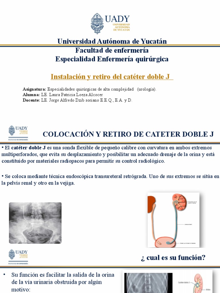 Presentacion de Retiro y Colocacion de Cateter Doble J | Descargar ...