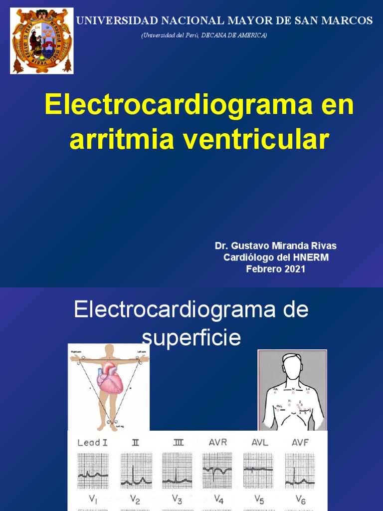 Arritmias Ventriculares y Taquicardias | PDF | Electrocardiografia ...