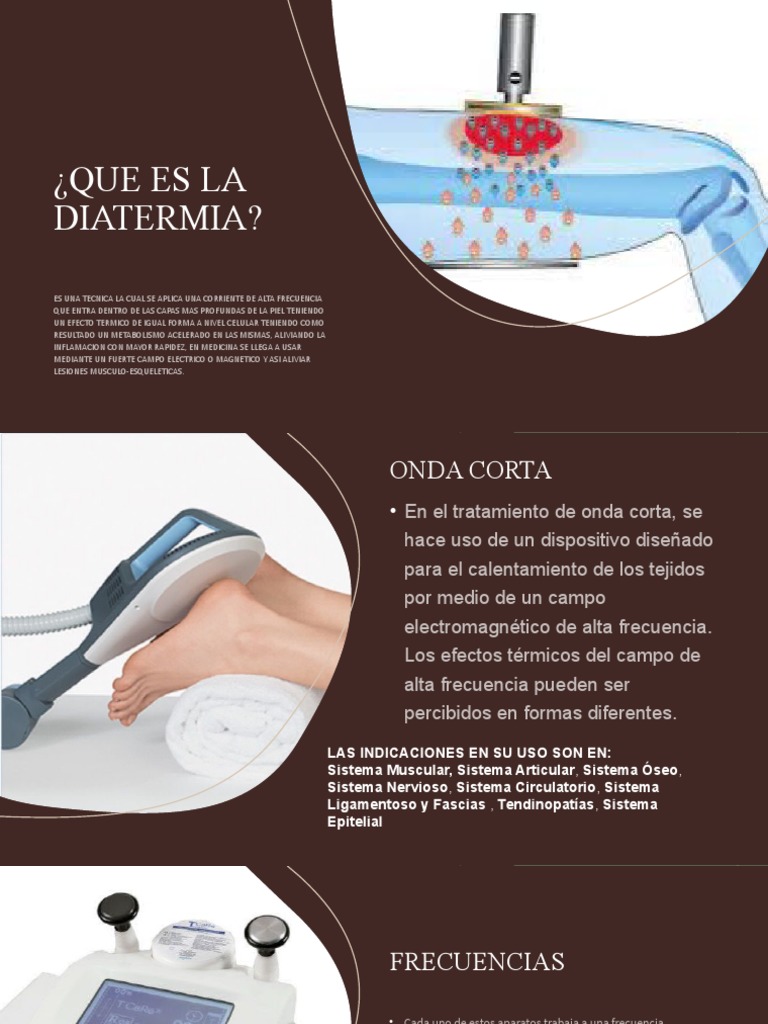 Diatermia de Onda Corta en Fisioterapia | PDF | Frecuencia de radio ...