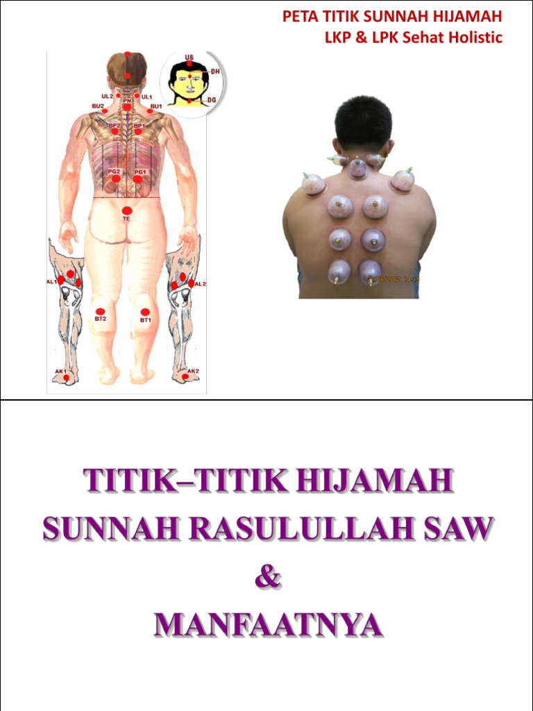 Titik Sunnah Hijamah | PDF