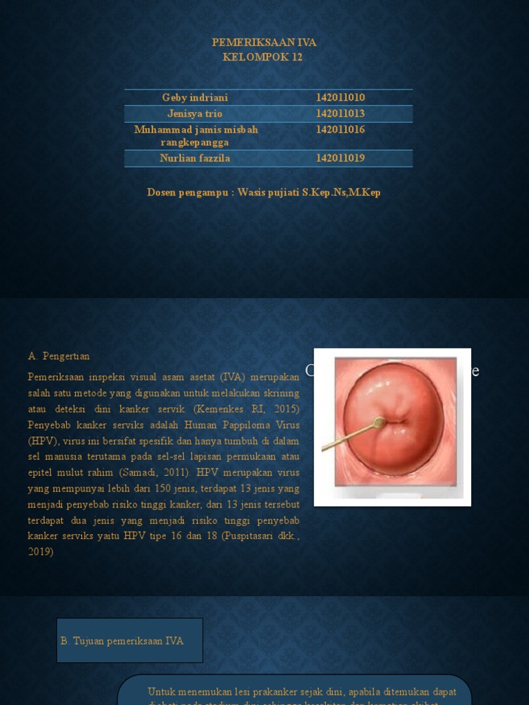 Pemeriksaan Iva Kelompok 12 Geby Indriani 142011010 Jenisya Trio 142011013 Muhammad Jamis Misbah ...