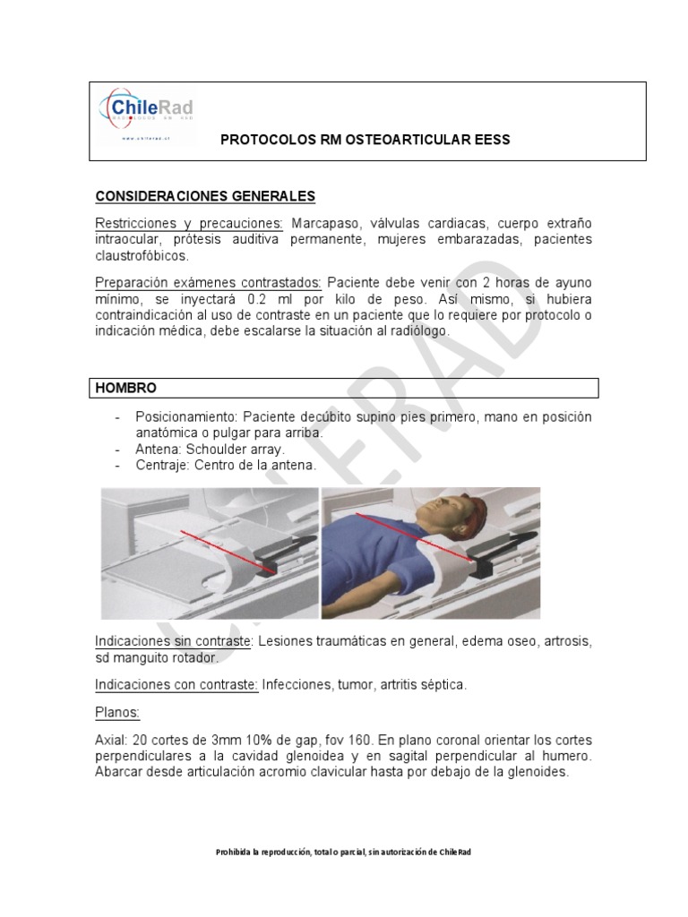 CHILERAD Protocolos RM Osteoarticular EESS | PDF | Mano | Anatomía