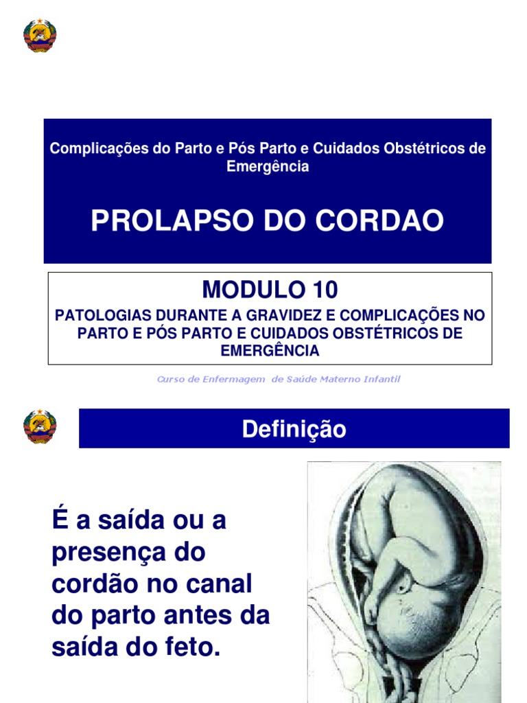 Prolapso de Cordão | PDF | Parto | Gravidez