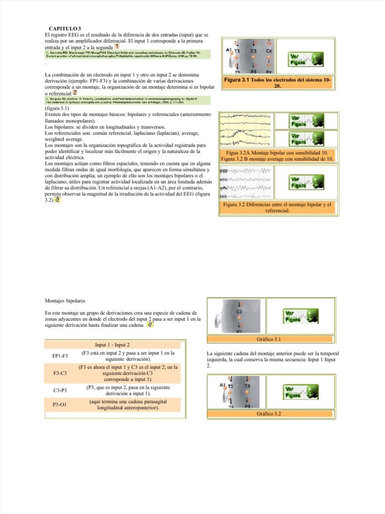 Fdocuments - Ec - Curso Eeg Modulo I Montajes | PDF | Desorden bipolar