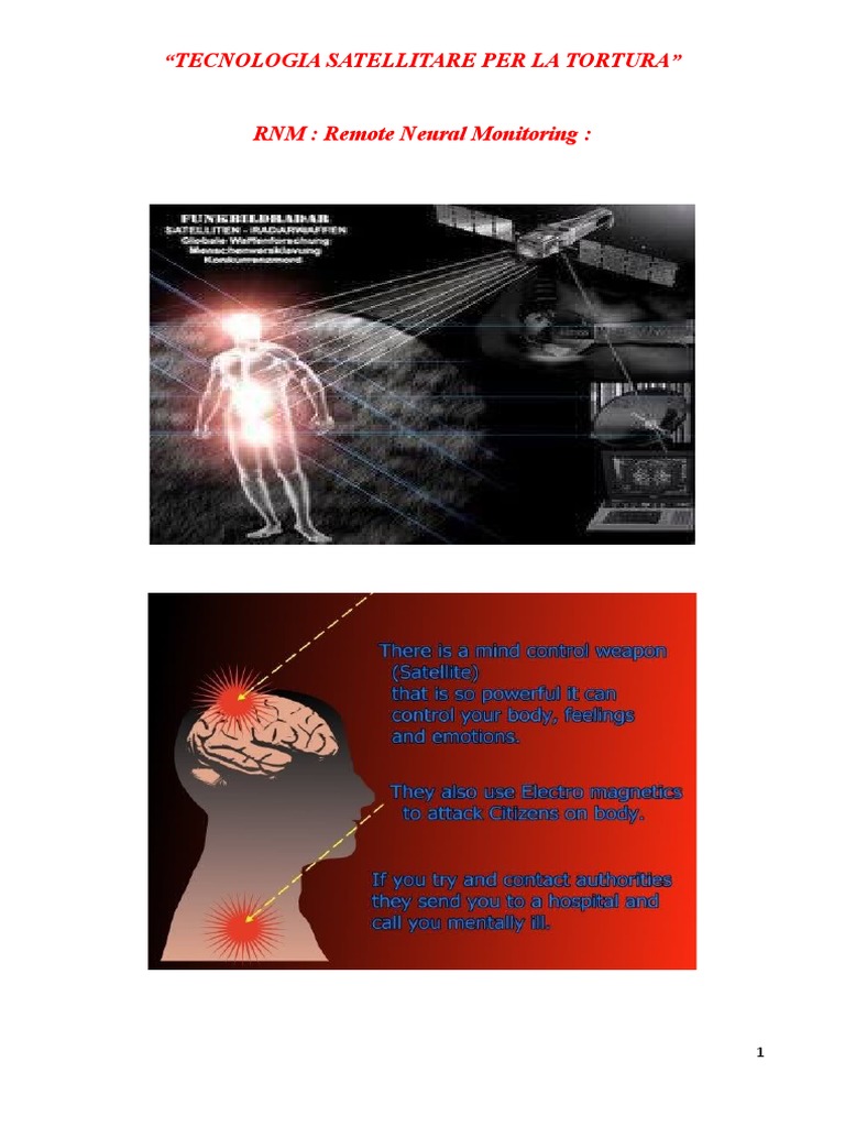 RNM (Remote Neural Monitoring) | PDF