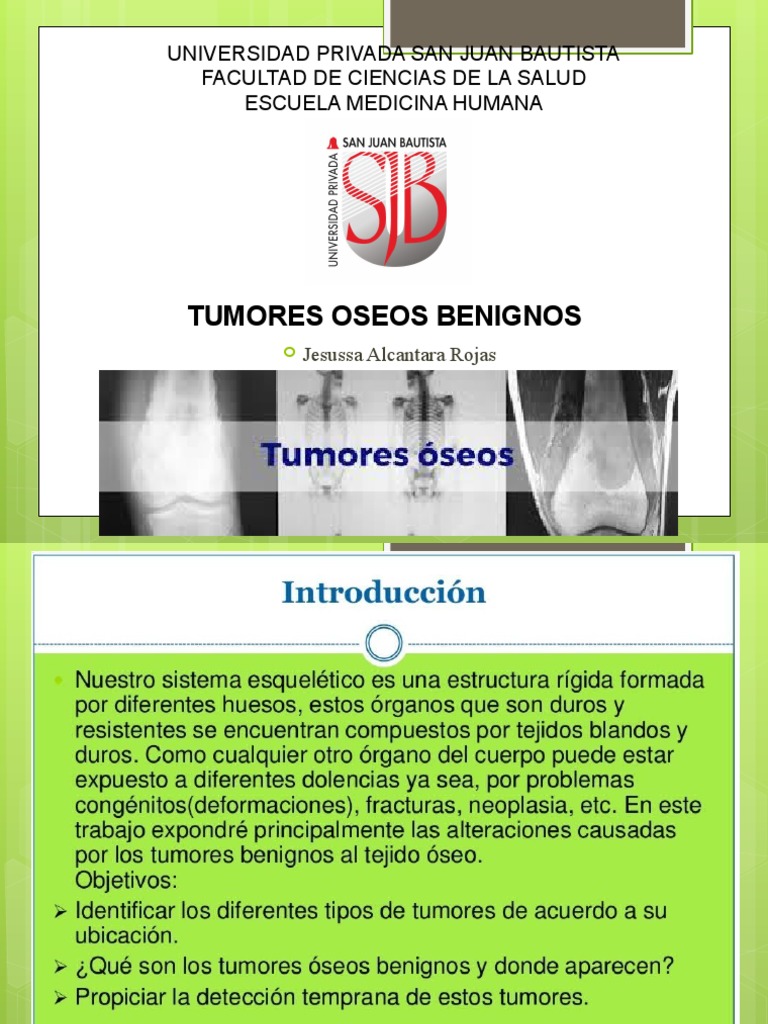 Tumores Oseos Benignos | PDF | Salud y bienestar