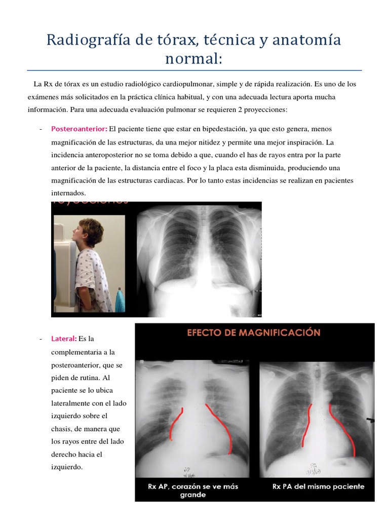 Radiografía y anatomía del tórax | PDF | Pulmón | Tórax (anatomía humana)