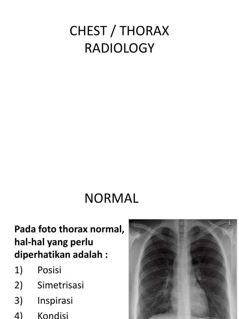 3.chest X Ray | PDF