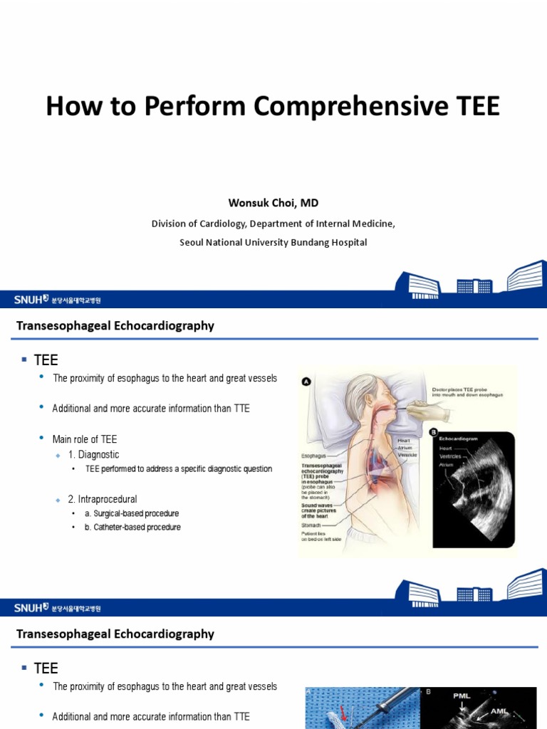 How To Perform Tee | PDF | Echocardiography | Esophagus