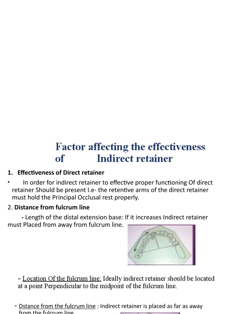 Indirect Retainers in RPD Design | PDF