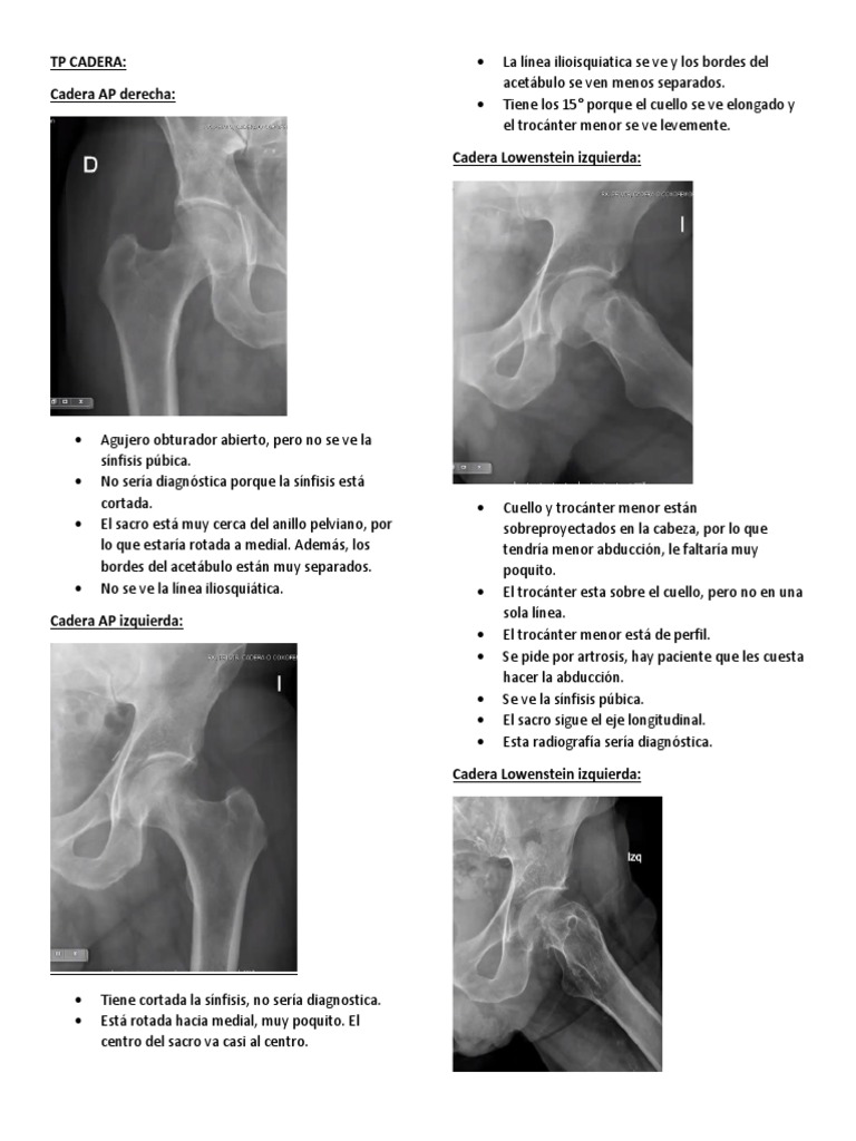 TP Cadera | Descargar gratis PDF | Sistema musculoesquelético | Sistema ...