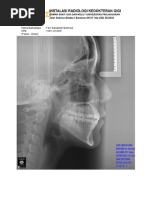 Interpretasi Hasil Foto Rontgen Anatomi Normal | PDF