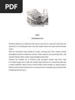 SOP Pemasangan Infus Lengkap Sesuai Standar Akreditasi | PDF