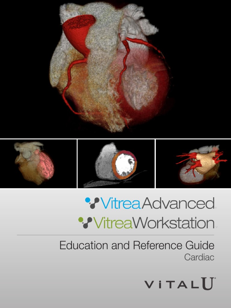 Vitrea Advanced Cardiac Edu Ref Guide | PDF | Ct Scan | Cardiovascular ...