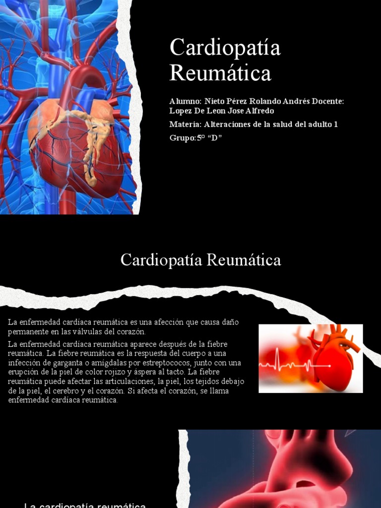 Cardiopatía Reumática | PDF | Cuidado de la salud | Epidemiología