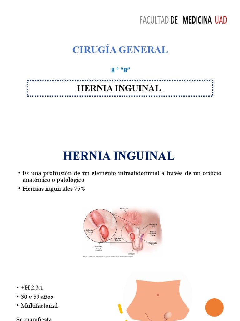 Hernia Inguinal | PDF | Abdomen | Cirugía