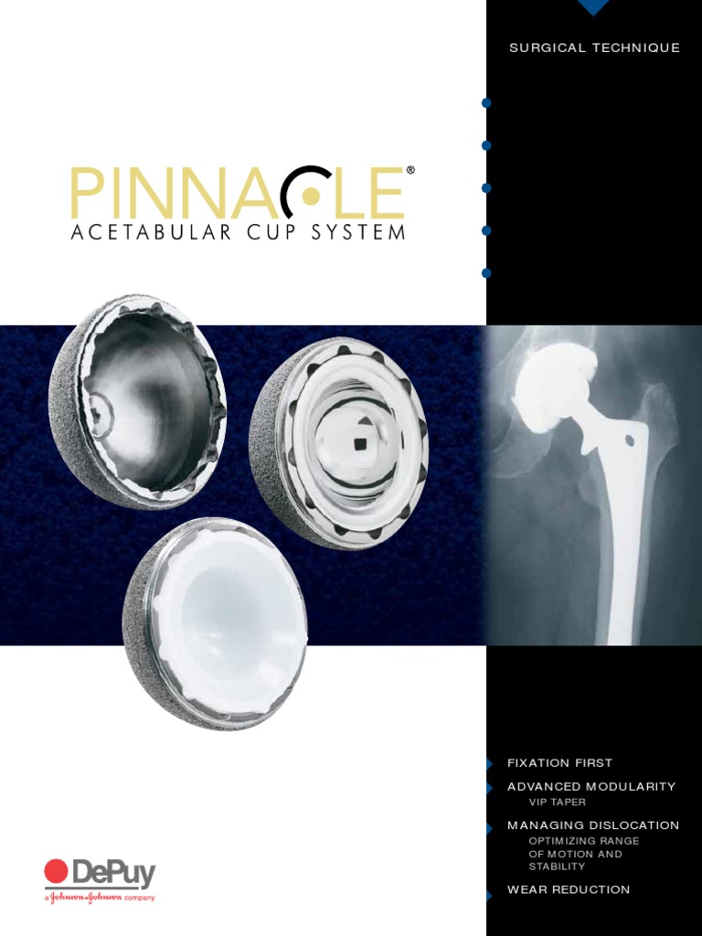 Pinnacle Tecnica Quirurgica 2 | PDF | Orthopedic Surgery | Hip