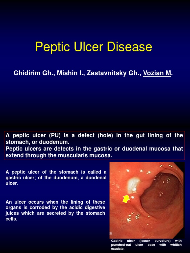 Peptic Ulcer and Complications | PDF | Stomach | Digestive System