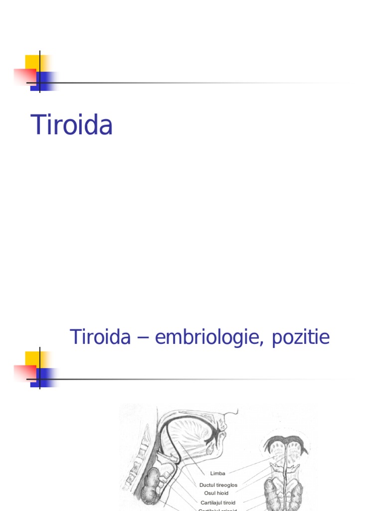 Tiroida