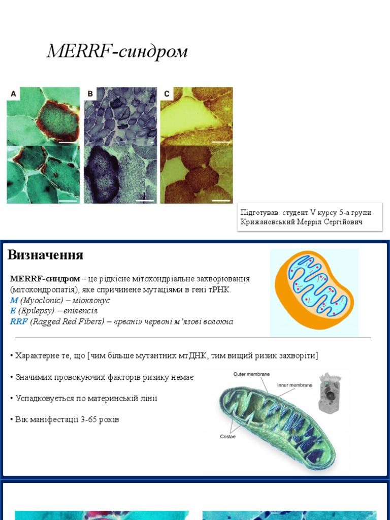 MERRF синдром | PDF