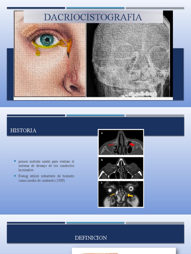 DACRIOCISTOGRAFIA | PDF | Biopsia | Medicina