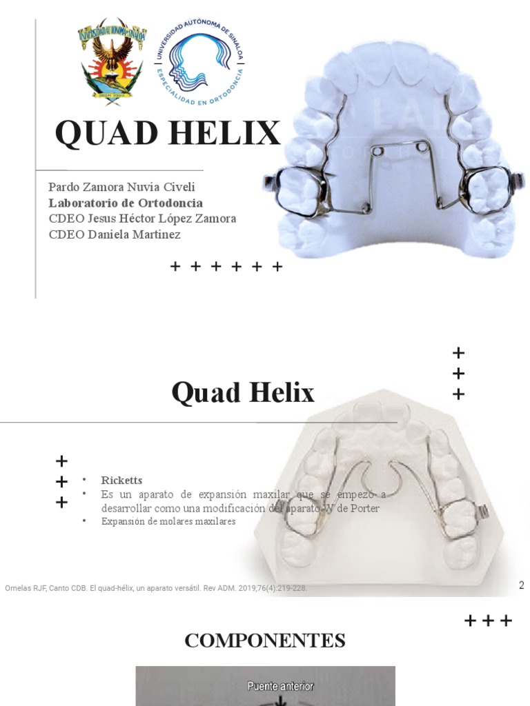T3 Quad Helix | PDF | Ortodoncia | Anatomia dental