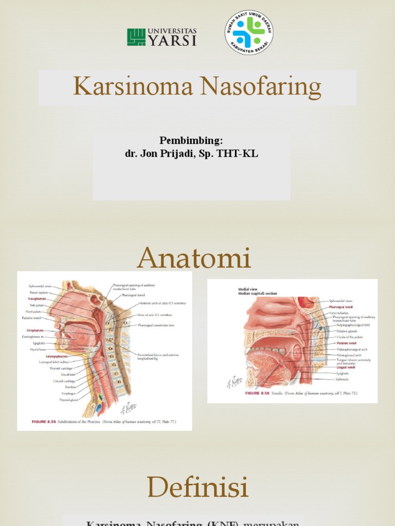 (THT) CA Nasofaring | PDF