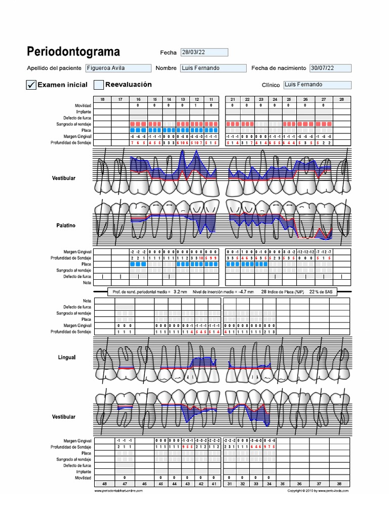 Periodontal Chart Online | PDF