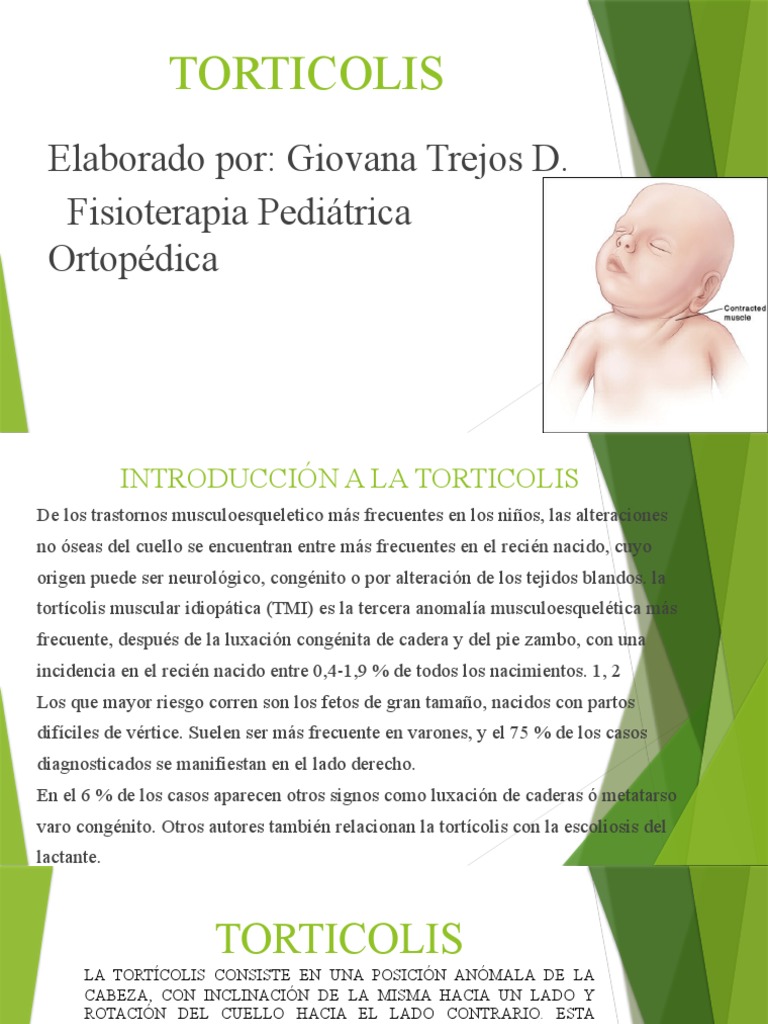 Tratamiento y Causas de Tortícolis Infantil | PDF | Medicina | Medicina ...