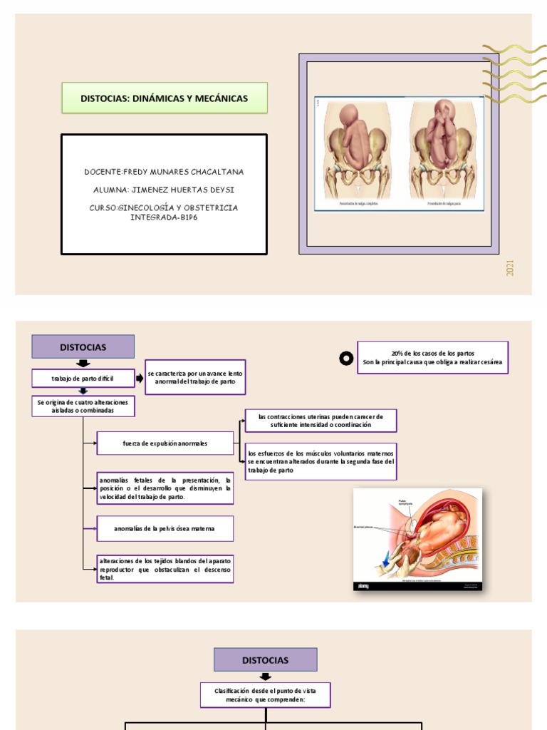 Distocias: Causas y Clasificación | PDF | Parto | Pelvis