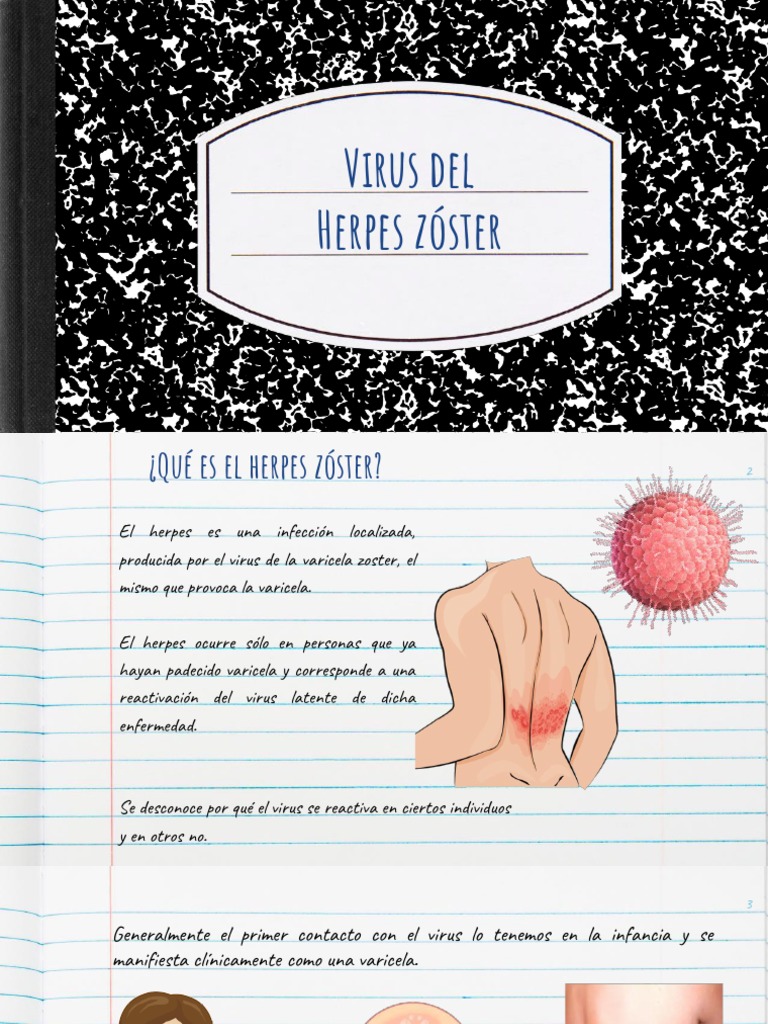 Herpes Zóster | PDF | Herpes Simple | Medicina CLINICA