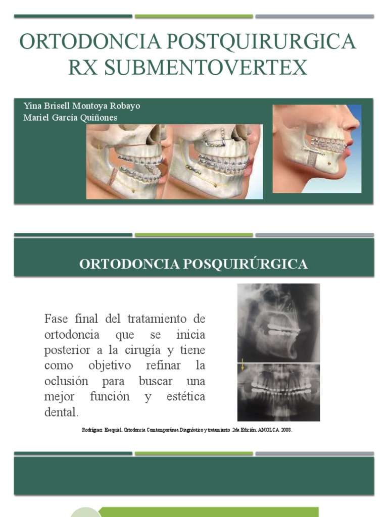 Ortodoncia Postqx y RX Submentovertex | PDF | Ortodoncia | Cráneo