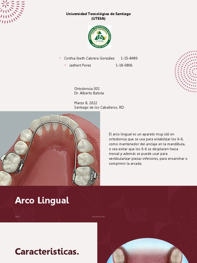 Arco Lingual | PDF | Ortodoncia | Ramas de Odontología