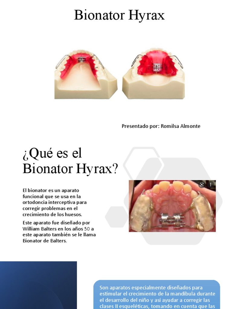 Bionator Hyrax | PDF