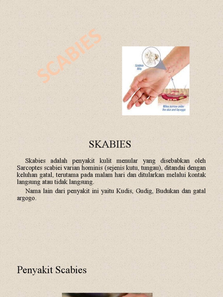 Scabies | PDF