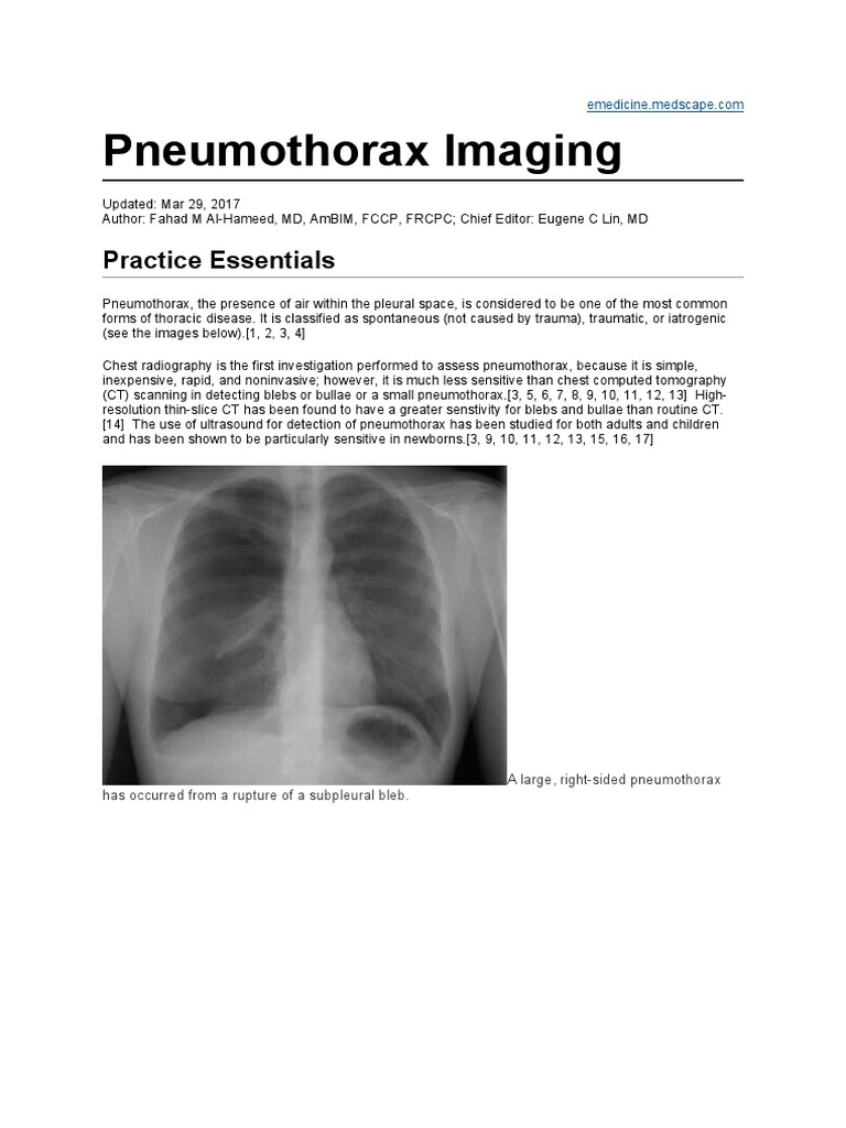 Pneumothorax Imaging Techniques Explained | PDF | Clinical Medicine | Medical Specialties