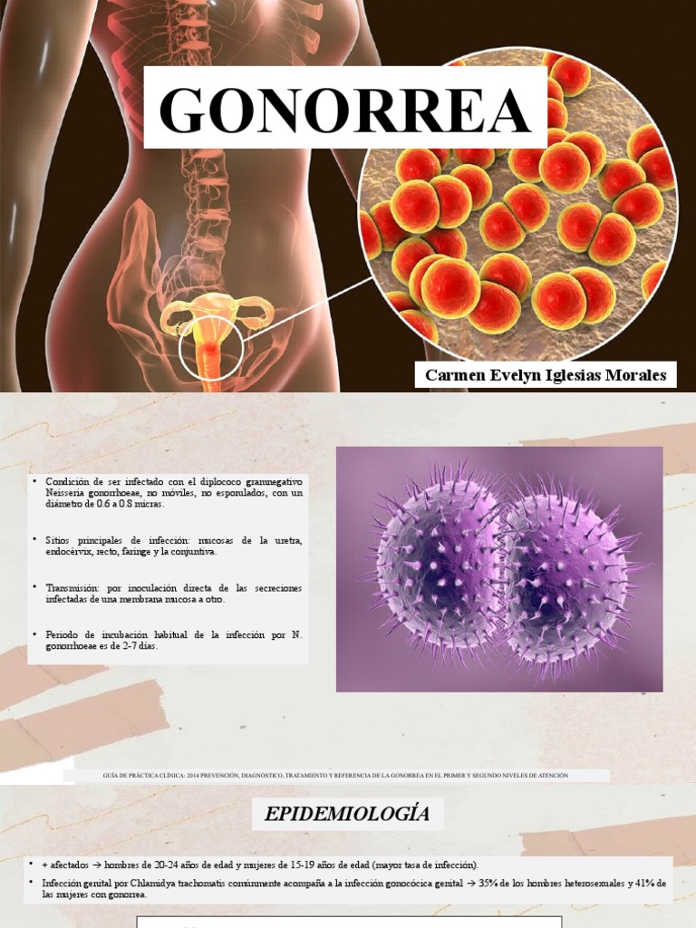 GONORREA | PDF | Especialidades Medicas | Causas de la muerte