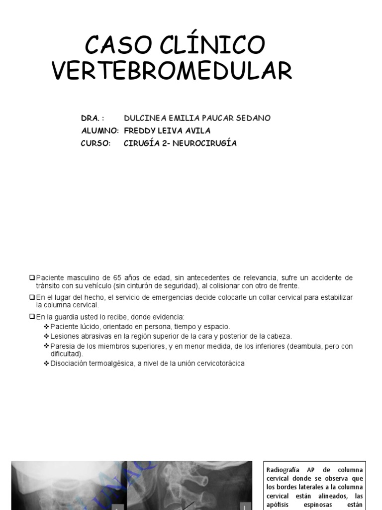 Traumatismo vertebromedular por fractura de C3: caso clínico y ...