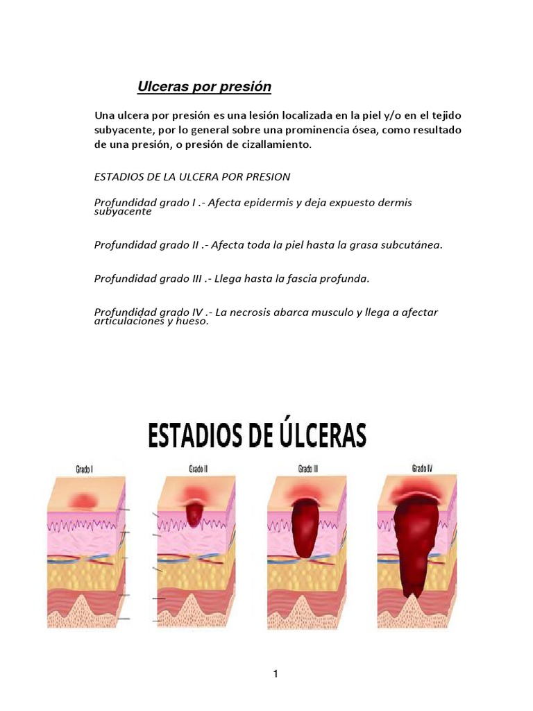 Estadios de La Ulcera Arredondo | PDF | Herida | Piel