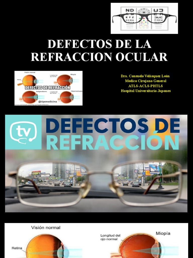 Defectos de La Refraccion Ocular | PDF