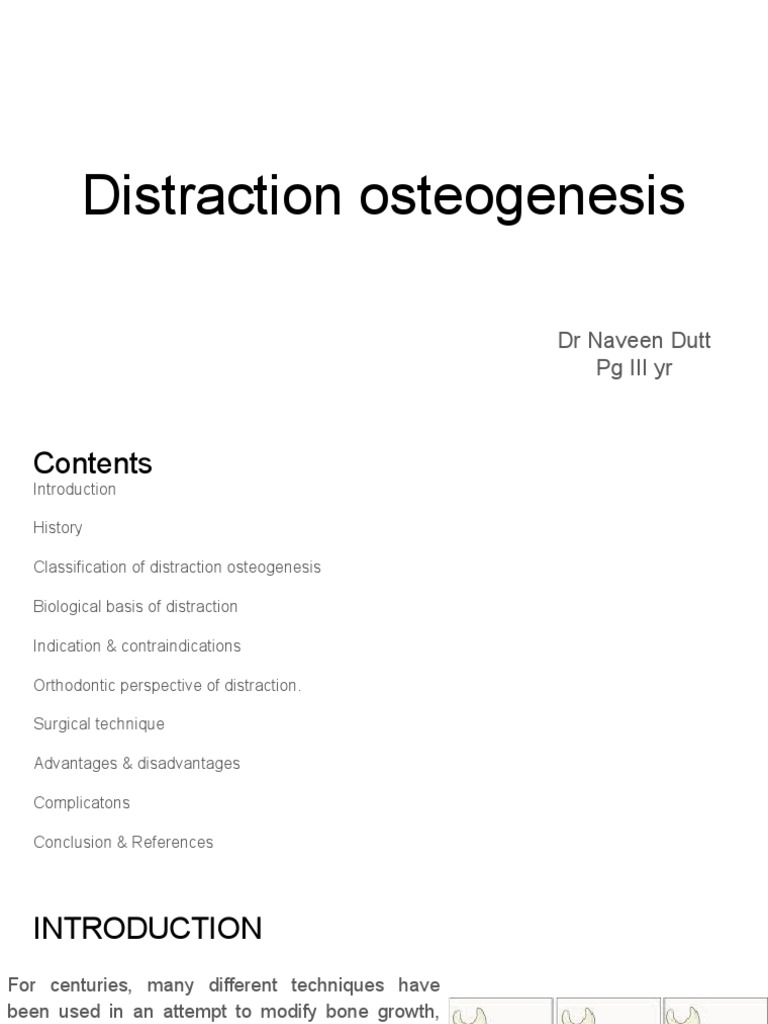 Distraction Osteogenesis Overview | PDF | Dentistry Branches | Clinical ...