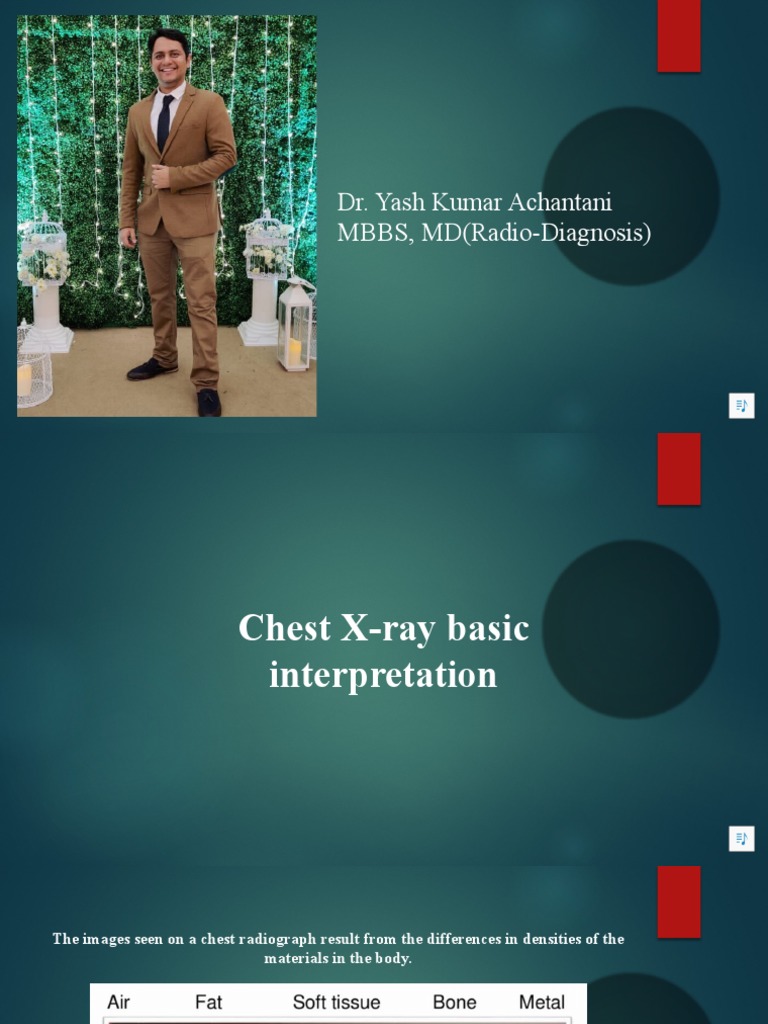 Chest X-Ray Interpretation Guide | PDF | Science & Mathematics