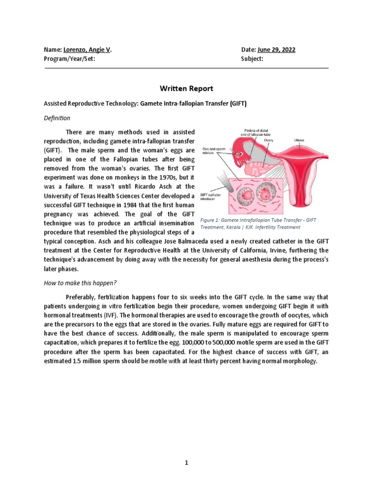 An Overview of Gamete Intra-fallopian Transfer (GIFT) as an Assisted ...