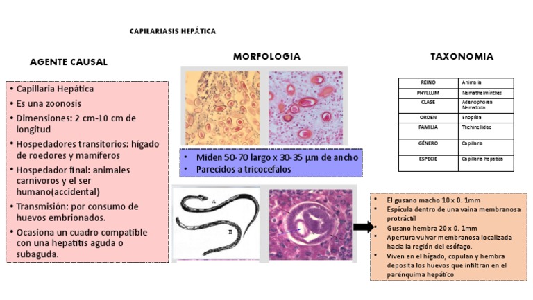 Capillaria Hepática: Zoonosis y Morfología | PDF