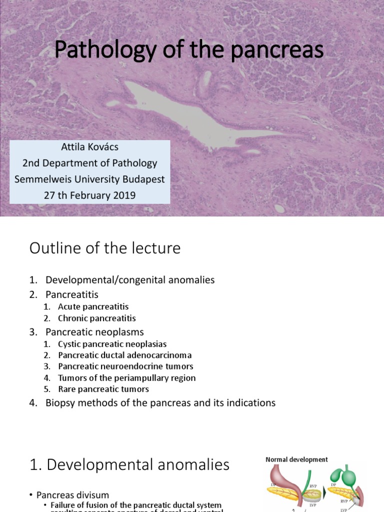 Kovacs Pancreas Pathology | PDF | Pancreas | Pancreatic Cancer