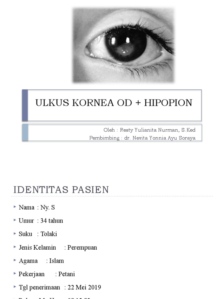 Ulkus Kornea Od + Hipopion | PDF