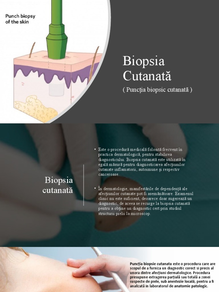 Presentation1biopsia Cutanata | PDF