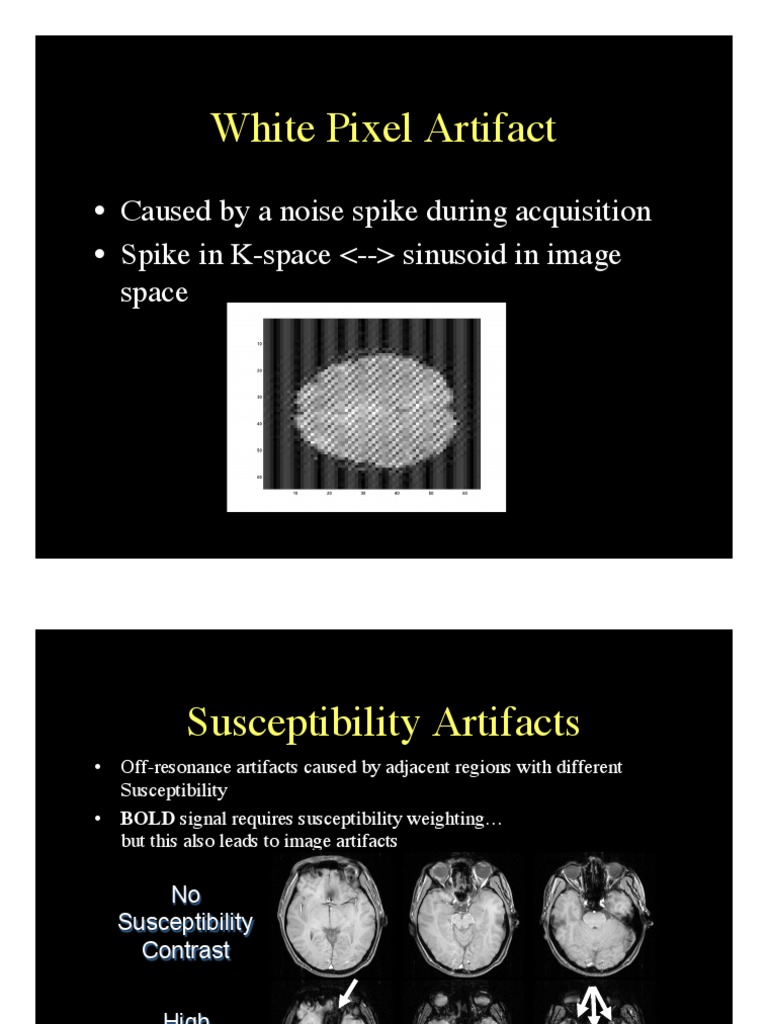 White Pixel Artifact Causes and Solutions | PDF | Signal Processing
