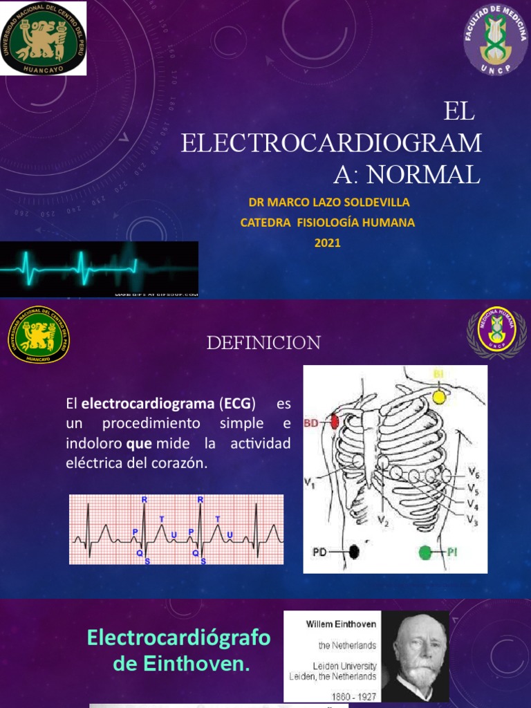 Taller de Ekg | PDF | Electrocardiografia | Imagenes medicas