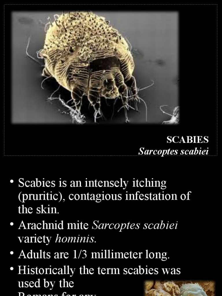 Sarcoptes Scabiei: Scabies | PDF | Health Sciences | Immunology